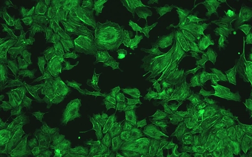 형광현미경 Standard Filter B (FITC Filter) : 네이버 블로그