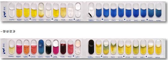 API kit, 간편한 세균 동정키트 : 네이버 블로그