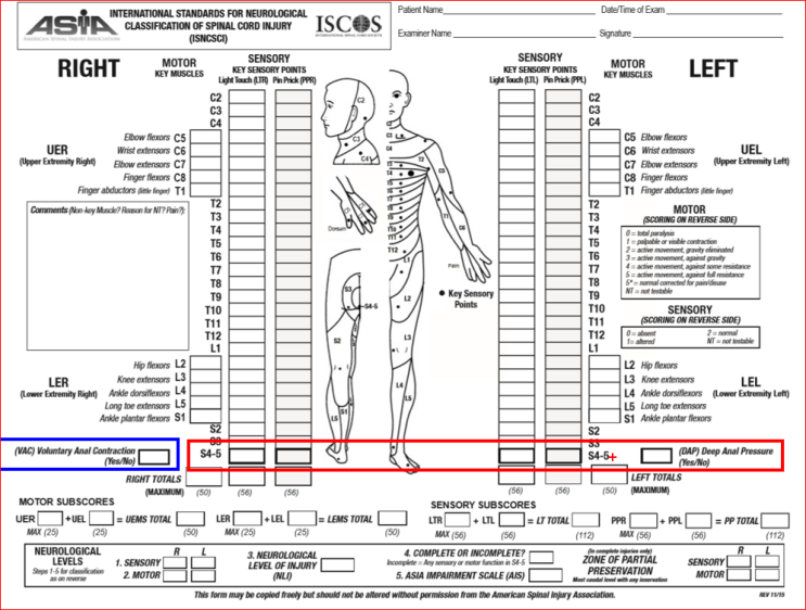 ISNCSCI 쉽게 이해하기(ASIA scale) - #4 완전손상 l 불완전손상 l ASIA level l ZPP란 무엇 ...