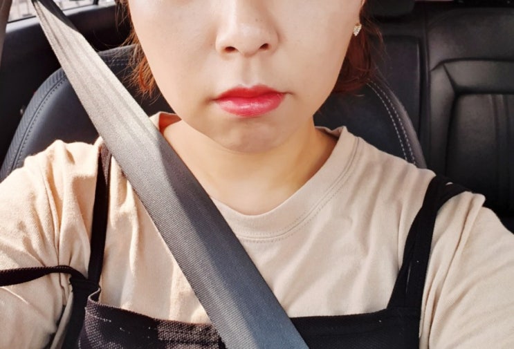 사랑니 발치 실비보험 청구 됩니다 매복사랑니 발치 일주일 후기 네이버 블로그