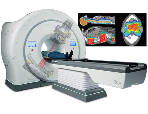 Tomotherapy (토모테라피)란? : 네이버 블로그