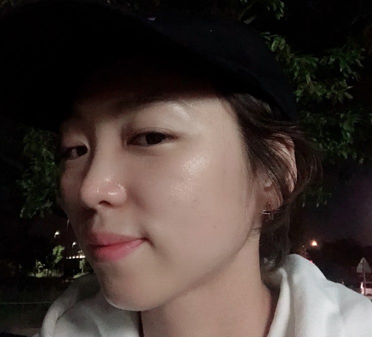 압구정 피부과에서 네오빔 레이저받기 좁쌀여드름 과다피지 안녕 네이버 블로그