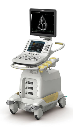 [신규의료장비 도입] 초음파 ARIETTA 60 : 네이버 블로그