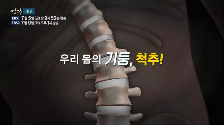 Ebs명의 허리가 아프신가요 허리통증 원인과 치료법 허리디스크척추관협착증척추전방전위증 네이버 블로그