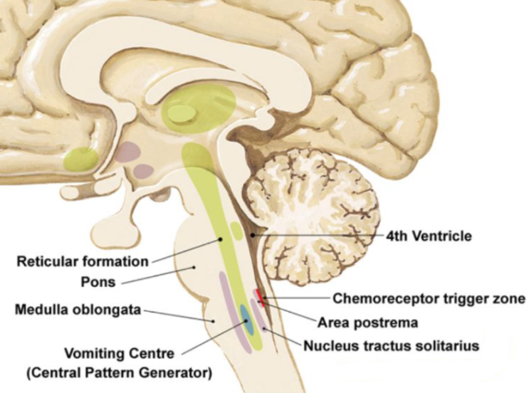 항구토제(antiemetics) 원리, 구토(vomiting) 유발기전, 구역의 분류, 화학수용체 자극대 ...