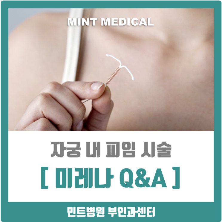 문정역 산부인과 생리를 중단하다 미레나 시술 효과 및 부작용 Qanda 네이버 블로그
