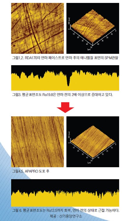 의료용 나노 하이드록시아파타이트(nano medical hydroxyapatite) 이용한 치아재광화촉진제, 아파프로 ...