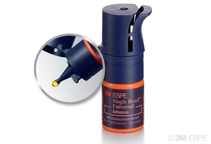 "3M Single Bond Universal Adhesive" : 네이버 블로그