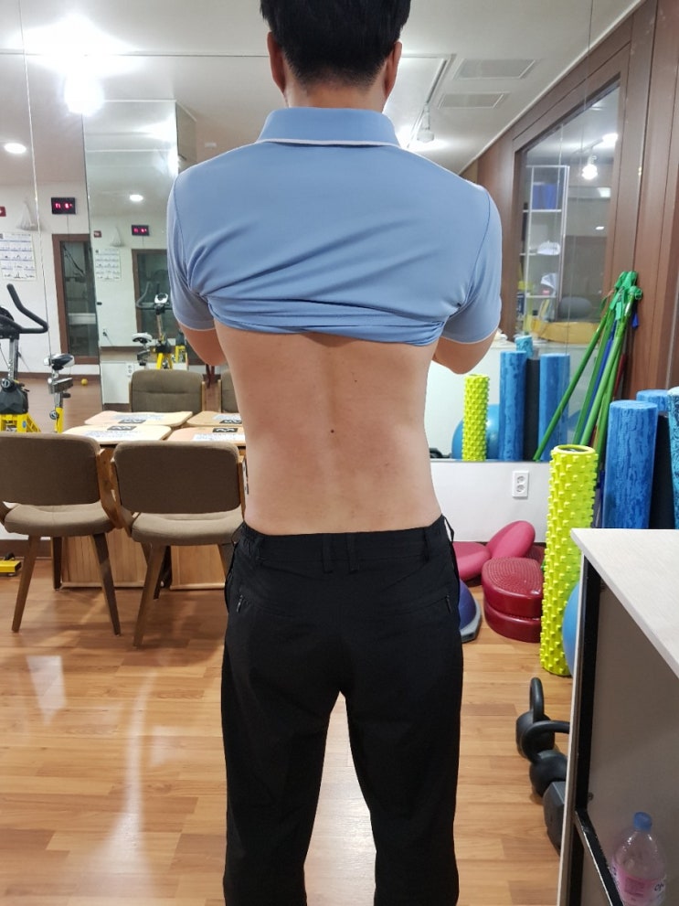 Antalgic Posture (통증 회피성 보상 자세) 에 대해서 : 네이버 블로그