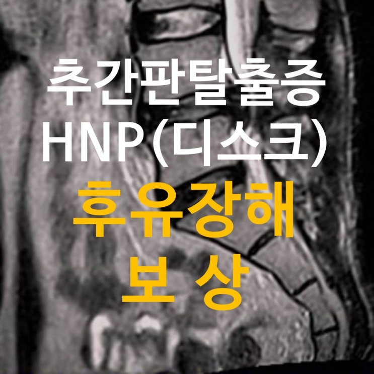 [추간판탈출증 HNP (디스크) 후유장해]- 추간판탈출증, HNP 디스크 상해후유장해 보상 : 네이버 블로그