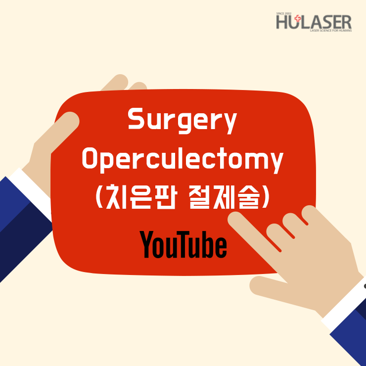 Surgery - Operculectomy (치은판 절제술) : 네이버 블로그