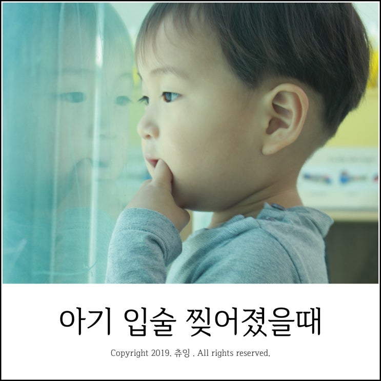 아기 입술 찢어짐 입술 터짐 병원가야하는 상황은 네이버 블로그