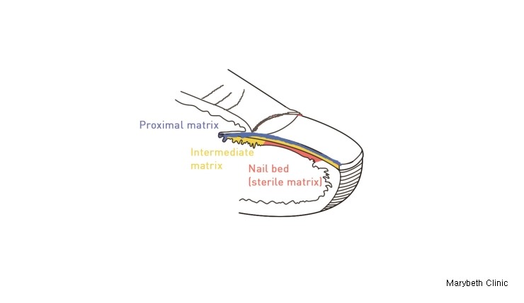 2. 손발톱바탕질(nail matrix) : 네이버 블로그