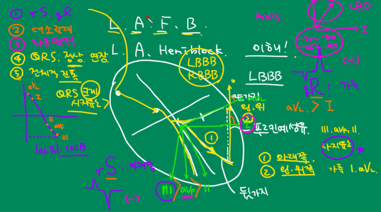 Left anterior fascicular block/hemiblock(좌각앞속차단, 좌각전지블록) 심전(ECG) 원리 ...