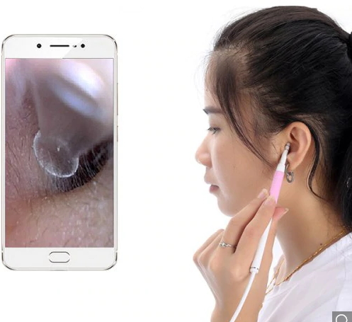 [버섯] 귀 청소용 내시경 - AN102 Ear Cleansing Endoscope : 네이버 블로그