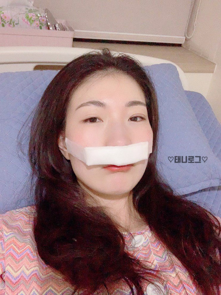 비염수술 리얼 후기 비중격만곡증하비갑개절제 수술 후기 비염수술입원비염수술통증자세한 후기 네이버 블로그