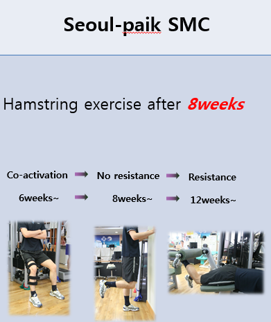 내측 반월 연골판(반월상 연골) 후방 골기시부 파열(medial meniscus posterior root tear, MMPRT ...