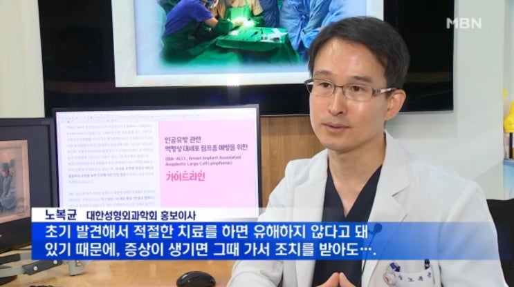 유방 보형물 연관 역형성 대세포 림프종 BIA-ALCL 관련 정리_v20200513 : 네이버 블로그