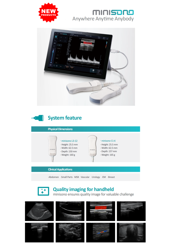 새로운 장비 미니소노(minisono)를 소개합니다. : 네이버 블로그