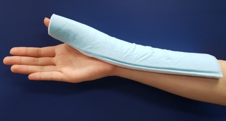 Short Arm Thumb Spica Splint : 네이버 블로그