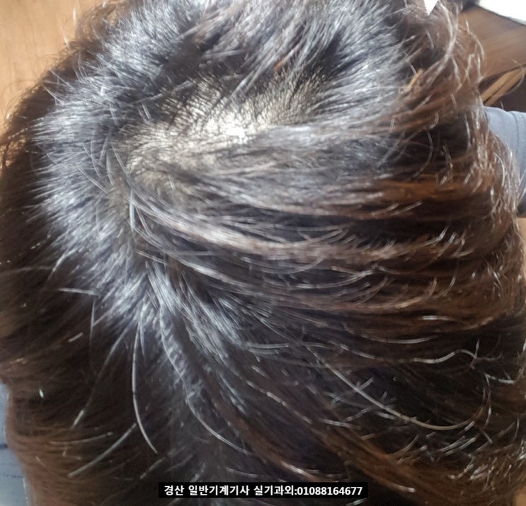 올리브영토닉 머리숱많아지는법 머리카락굵어지는법 두피토닉 데일리 안티 헤어로스 허브 헤어토닉 150ml 사용기 : 네이버 블로그