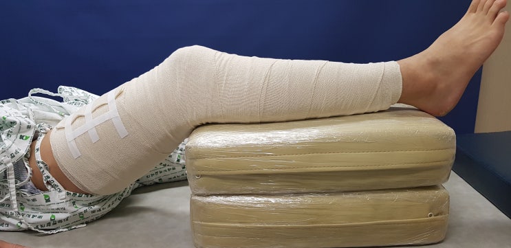 Cylinder Splint : 네이버 블로그