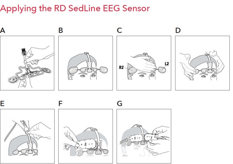 Masimo sedline and O3 sensor : 네이버 블로그