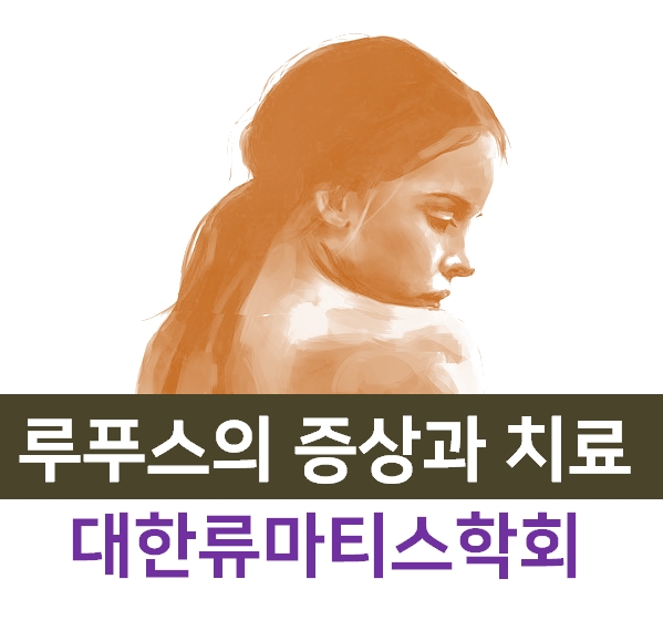 루푸스병 전신홍반 루푸스의 증상과 치료 대한류마티스학회 루푸스병 의학정보 네이버 블로그