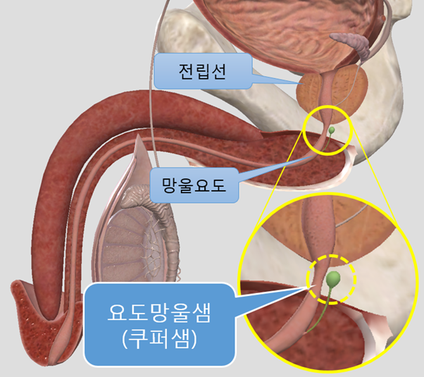 울산 비뇨기과 남자 요도 분비물의 원인 및 검사 네이버 블로그