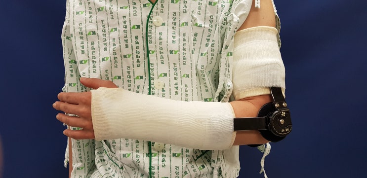 Long Arm Elbow Brace Cast : 네이버 블로그