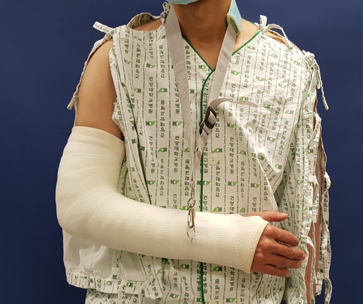 Long Arm Hanging Arm Cast : 네이버 블로그