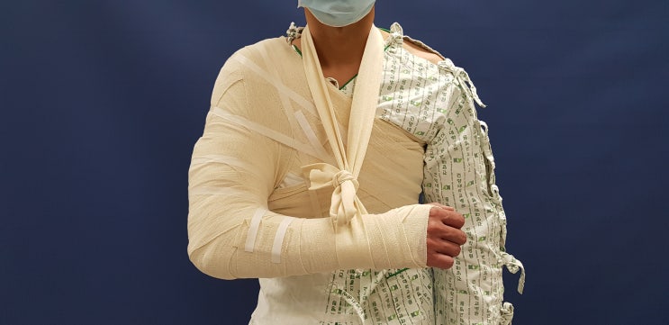 U-Slab Splint : 네이버 블로그