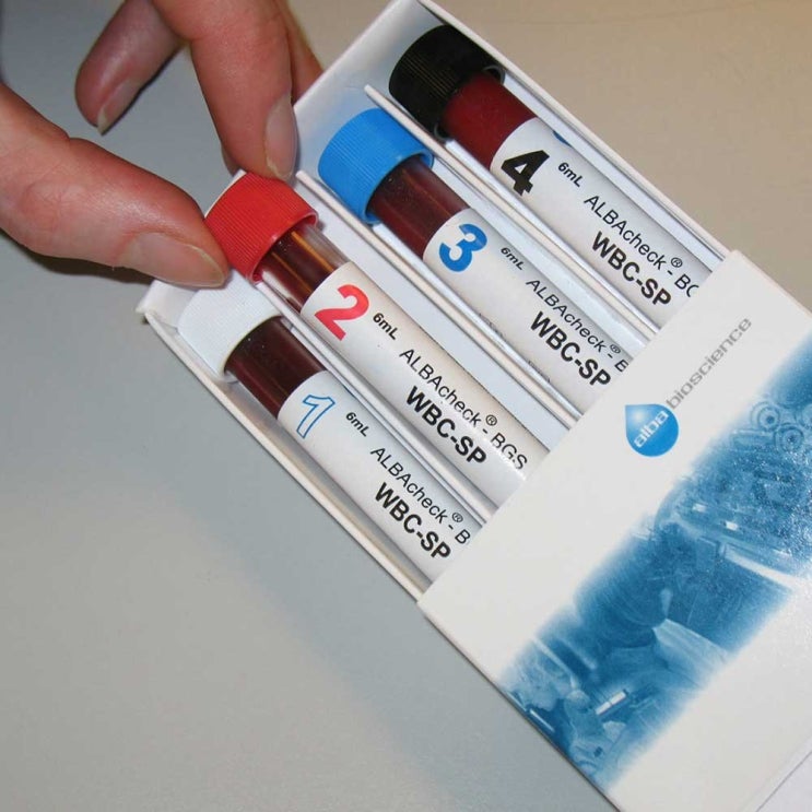 [Alpha Laboratories] Whole Blood control automated Blood grouping ...