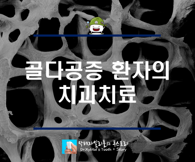 전신질환 :: 골다공증 환자의 치과치료 :: BRONJ / MRONJ 예방을 위해 주의해야할 비스포스포네이트 약제 : 네이버 블로그