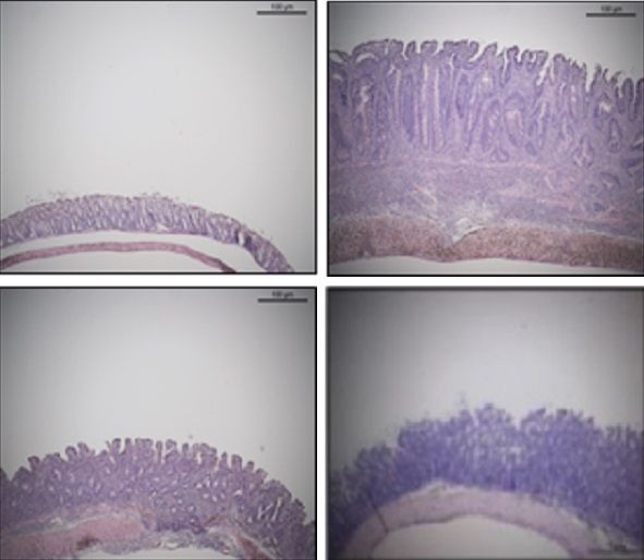 면역암치료? 암세포 제거하는 강력한 면역세포의 기능! 면역세포 기능 돕는 장내 미생물군의 세포표면다당체(CSGG) : 네이버 블로그