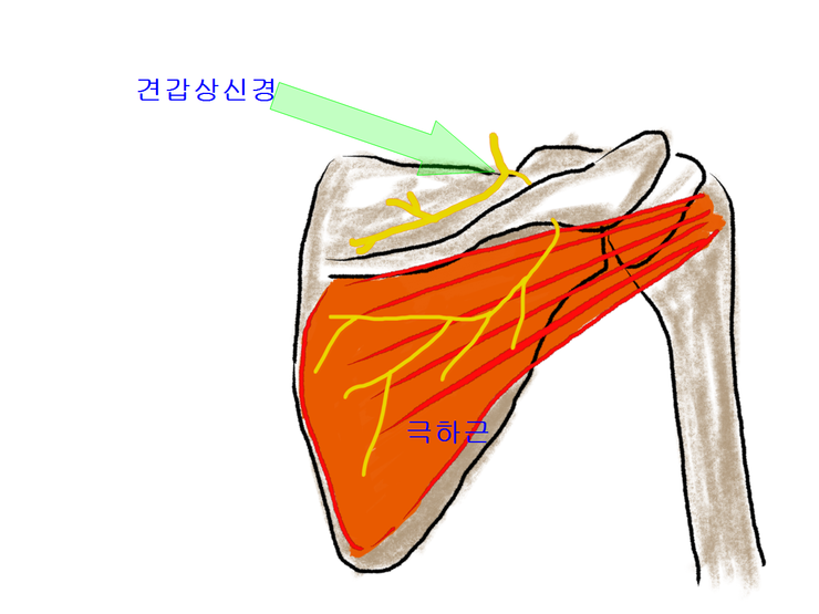대전 유성 어깨 통증 어깨 저림 어깨 근육 위축 견갑상 신경 포착 Suprascpular Nerve 네이버 블로그