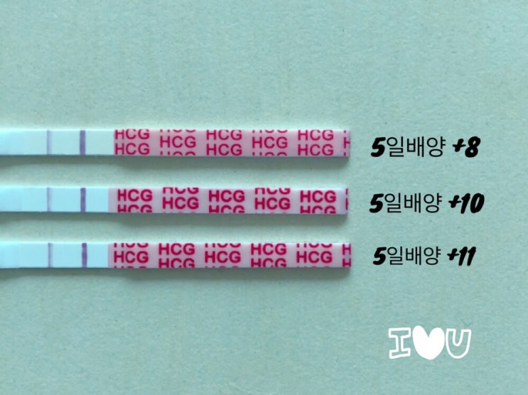 난임월드 시험관 6차 5일배양 이식 후 부터 10일 까지 증상 이식후 운동1차 피검사 통과 후기 네이버 블로그