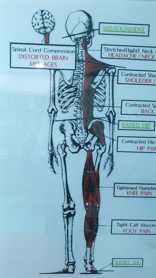 Why do you correct the turtle neck in your back pain?(Haeundae Marine ...