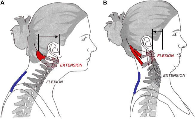 턱당기기 운동(chin-in / chin-tuck) 2/2 바른자세 : 네이버 블로그