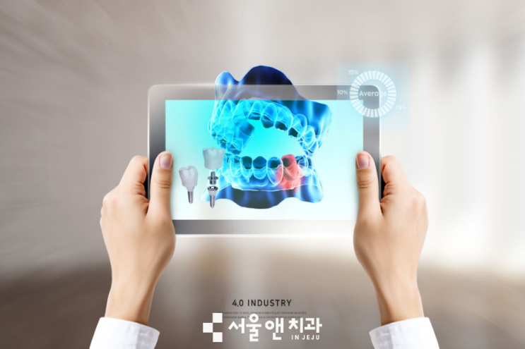 제주시민분들을 위한 임플란트 정보 : 네이버 블로그