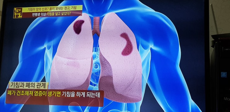 폐건강 목이간질간질한 기침 가래 더덕밥 포도식초만들기 네이버 블로그