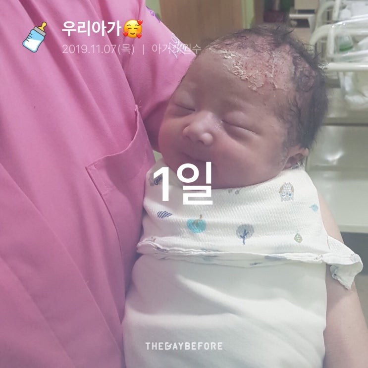 강이출산기록 초고도비만산모출산유도분만자연분만실패 후 제왕절개서울여성병원출산후기가족분만실분만대기실37주출산단백뇨검출