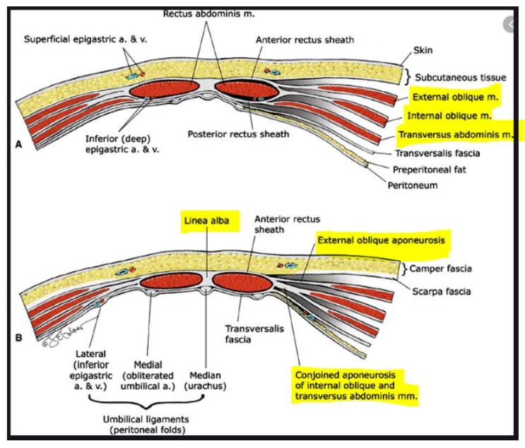 산후 복직근 이개/복직근 분리(Diastasis Recti Abdominis): 미국 여성건강 물리치료사의 관점에서 알아보는 ...