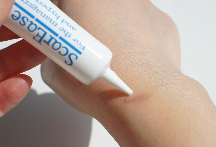 화상 흉터연고 상처자국 없애고 흉터개선 하자 : 네이버 블로그