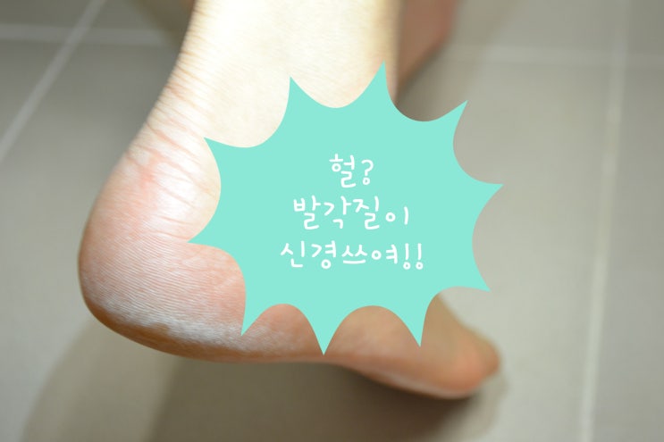 토소웅 풋 필링 스프레이 효과만점의 발각질제거 네이버 블로그