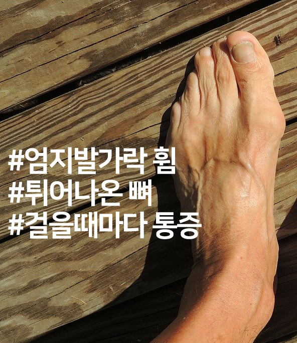 엄지발가락휨 pain 통증이 점점더 : 네이버 블로그