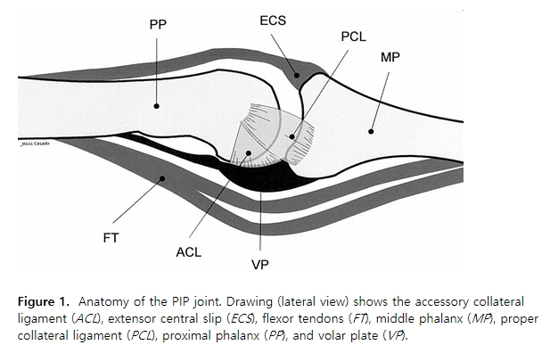 손가락 염좌의 진단 #1 finger sprain, 근위지간 관절 손상 PIP joint : 네이버 블로그