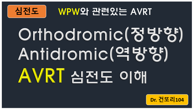 PSVT orthodromic(정방향)/antidromic(역방향) AVRT 심전도(ECG) 이해 : 네이버 블로그