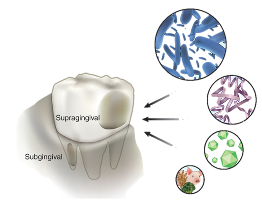 구강마이크로바이옴oral Microbiome과 건강의 상관관계한국의과학연구원 마이크로바이옴센터 네이버 블로그