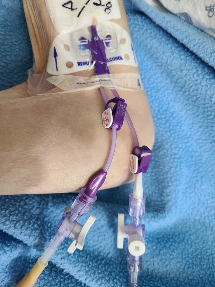 PICC (peripherally inserted central catheter) : 네이버 블로그